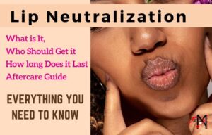 Lip Neutralization 101: What is It, What to Expect & Cost - MakeUp Zee